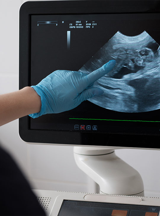Ultrassom morfológico de 2º trimestre (20 a 24 semanas) - Materno Fetal